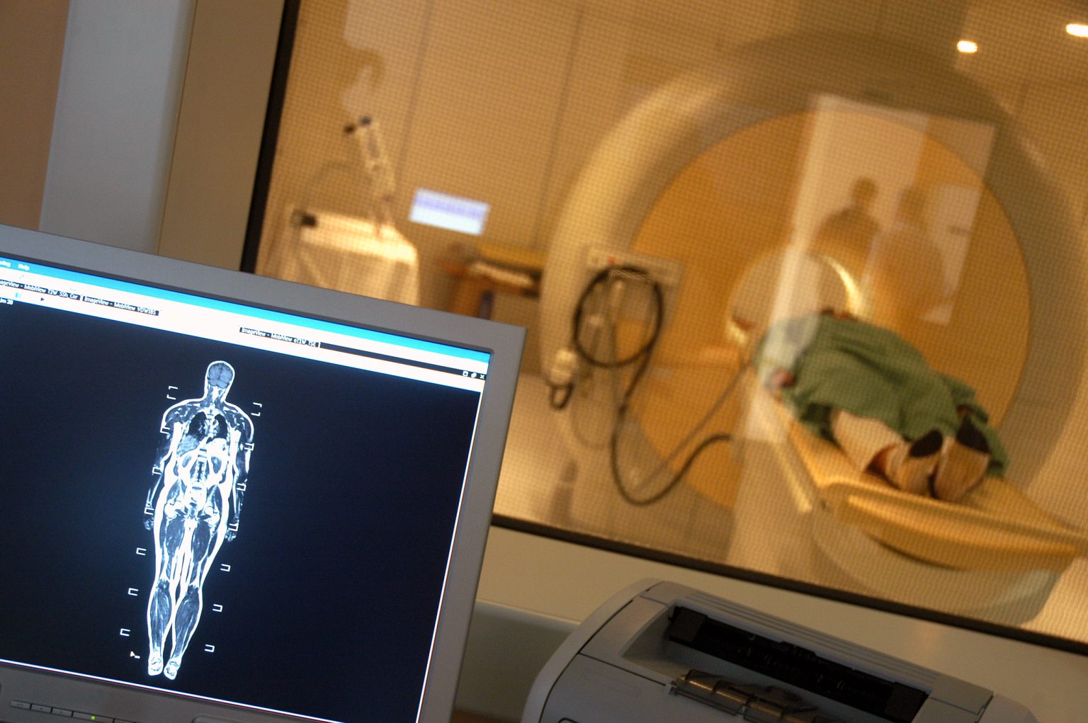 How Doctors Use MRI Before Giving an Injection