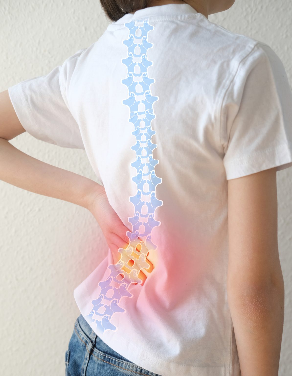 Why Does Sciatica Pain Come and Go?